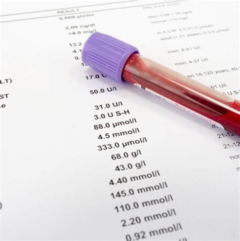 Пълна кръвна картина 3 въпроса които винаги трябва да зададете за вашия кръвен тест За Жената