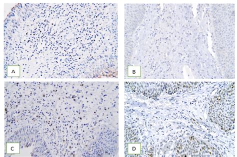 Foxp3 Cd4 Cd8 And P53 Expression In Sip With Dysplasia Group A Download Scientific Diagram