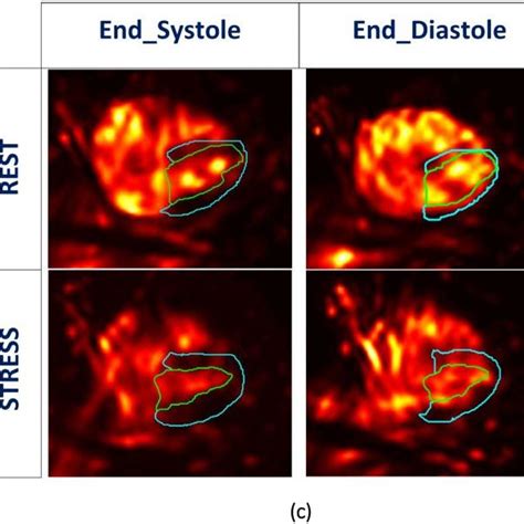 Figure For A Sample Subject A Fully Automated Organ Segmentation Download Scientific