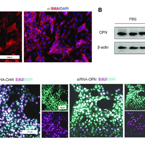 Accumulation Of Opn Activated Primary Hscs A Primary Hscs Were