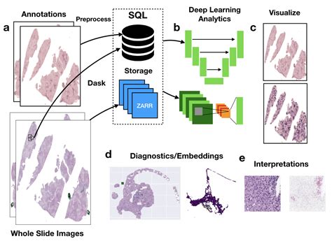 welcome to pathflowai s documentation — pathflowai 0 1 1 documentation