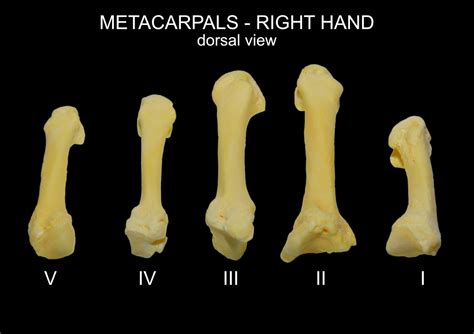Metacarpal Bones Clinical Anatomy