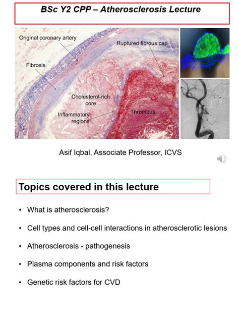 Atherosclerosis 2023 Cpp Lecture Pdf Atherosclerosis High Density