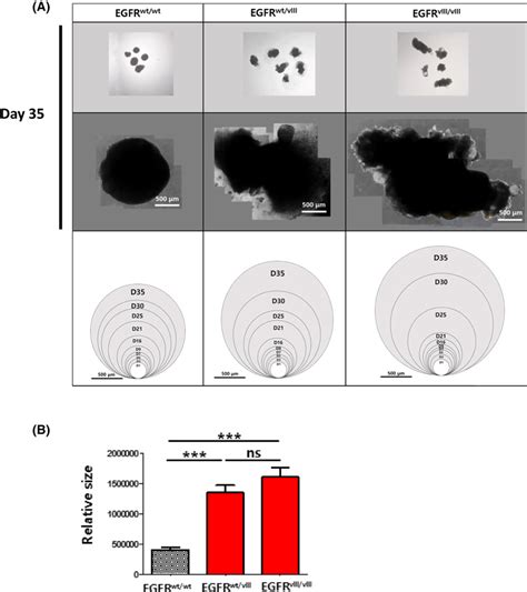 Size Comparison Of Normal And Egfrviii‐brain Organoids A The Download Scientific Diagram