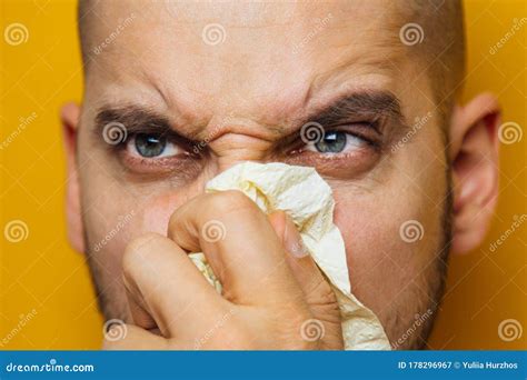 Hands With Allergy Reaction From Taking Medicines By Effect