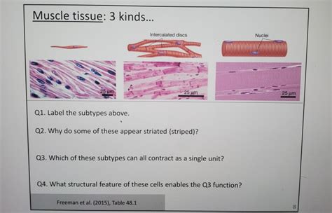 solved muscle tissue 3 kinds intercalated discs nuclei