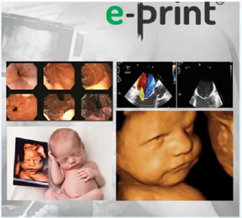 Offline Eprint Dicom Image Printing Software Solution At Rs 15000 In