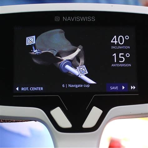 The Naviswiss Monitor After Cup Insertion Showing 40° Of Inclination Download Scientific