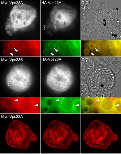 Colocalization Microscopy And Analysis Basics
