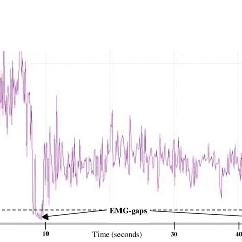 Schematic Graph Of Emg Gaps Muscle Activity As Percentage Of A Download Scientific Diagram
