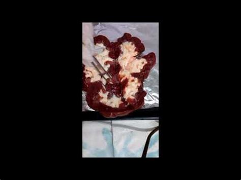 Disección De Riñon De Vaca Youtube