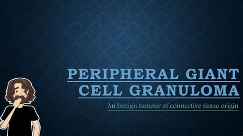 Peripheral Giant Cell Granuloma Of Oral Cavity Pptx