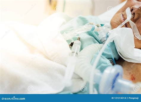 Patient Do Tracheostomy And Ventilator In Hospital Editorial Stock