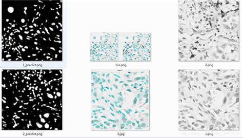 Mask R Cnn，unet，unet三种算法实现细胞分割的对比心得unet和mask R Cnn效果对比 Csdn博客