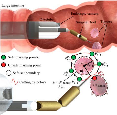 论文审查 Safety Ensured Control Framework For Robotic Endoscopic Task Automation