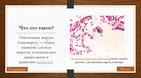 Онкогенные вирусы презентация онлайн