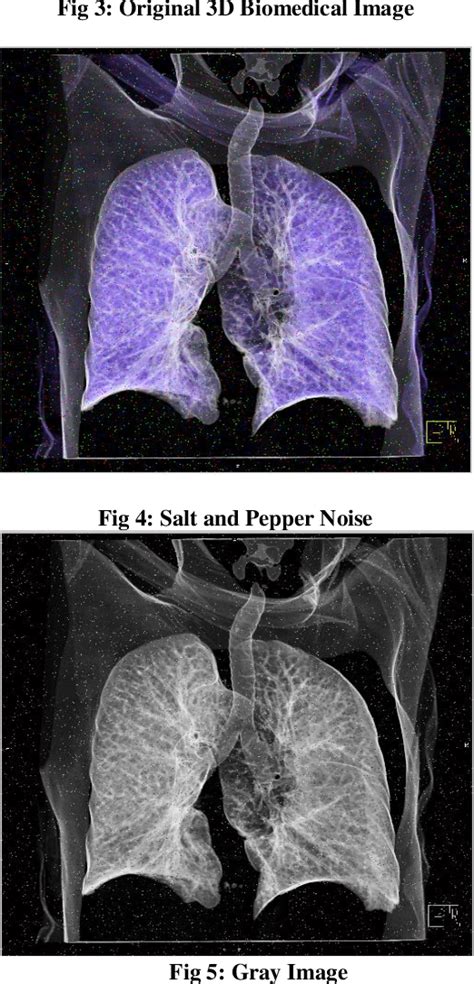 Figure 4 From Implementing Morphological Operators For Edge Detection On 3d Biomedical Images