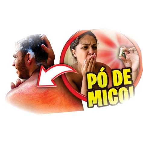 Pó De Mico Extra Forte