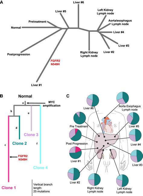 Tumor Heterogeneity And Acquired Drug Resistance In Fgfr2 Fusion Positive Cholangiocarcinoma