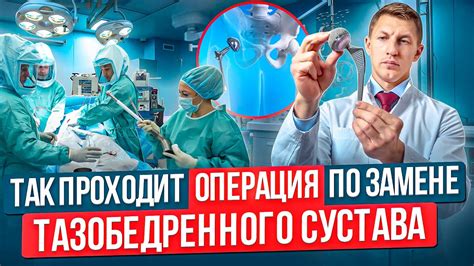 Эндопротезирование тазобедренного сустава Коксартроз Как проходит операция по замене сустава
