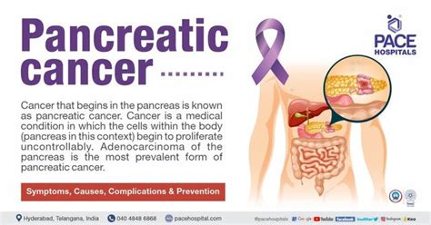 Early Stage Pancreatic Cancer Symptoms