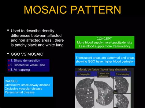 Patterns In Hrct Chest Pptx