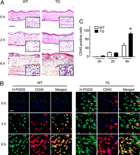 Figure 1 From Opposing Immunomodulatory Roles Of Prostaglandin D2