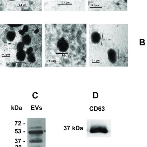 Csf Samples Clinical And Laboratory Diagnoses Of Aids Patients Download Scientific Diagram