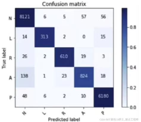 实现基于深度学习ecg心电信号分类，用多个数据集（mit Bih心率不齐数据库、mit Bih St变化数据库、欧盟st T心电数据库和心脏性猝死动态心电数据库）来训练和评估模型。心电信号
