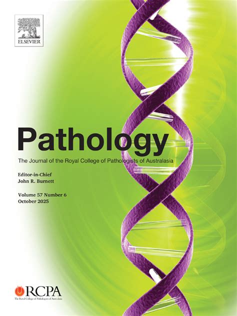 Exceptionally High Testosterone Levels In Men Pathognomonic Or Analytical Error Pathology