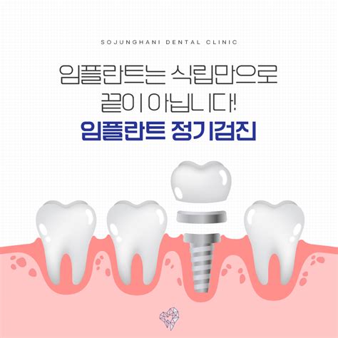 소중한이치과 광고 임플란트 식립만으로 끝이 아닙니다 임플란트정기검 소중한이치과