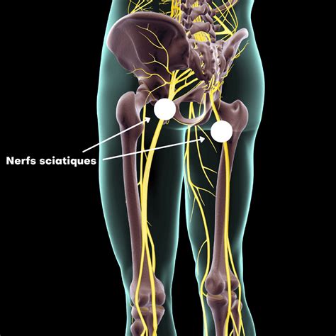 Nerf Sciatique Abimé Que Faire Nerf Sciatique Anatomie Bhby
