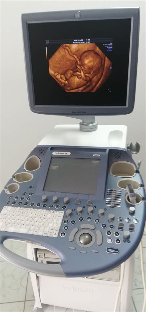 Voluson E8 Expert Bt13 Hd Live