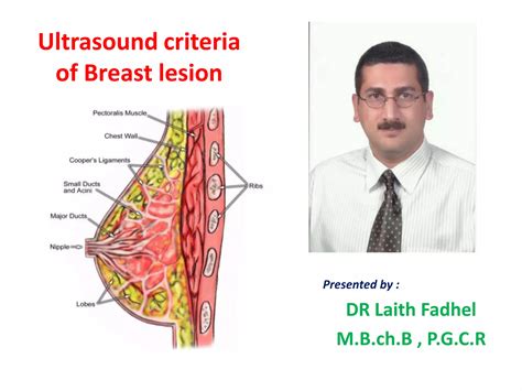 Breast Lesion By Ultrasound Pptx