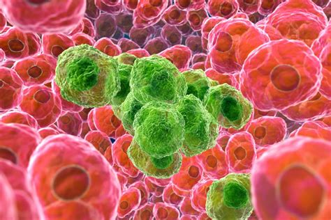 Brit Scientists Develop Genetically Modified Virus That Kills Cancer