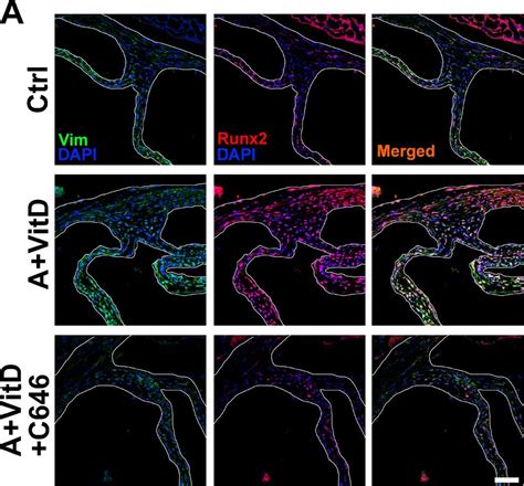 Runx2 Antibodies Antibody Search Engine Citeab