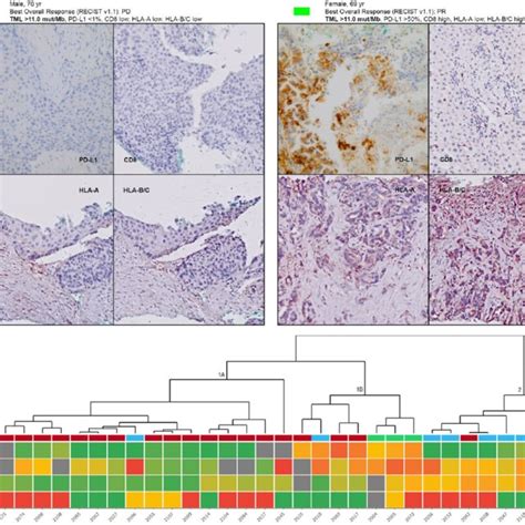Patient Examples And Cluster Analysis A Example Of Two Patients