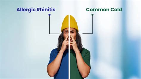 Allergic Rhinitis Vs Common Cold How To Tell The Difference
