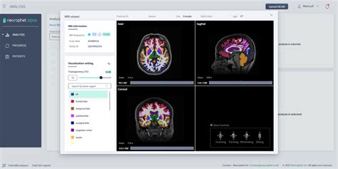 Reliability Of Ai Powered Brain Segmentation Across Varying Mri Field