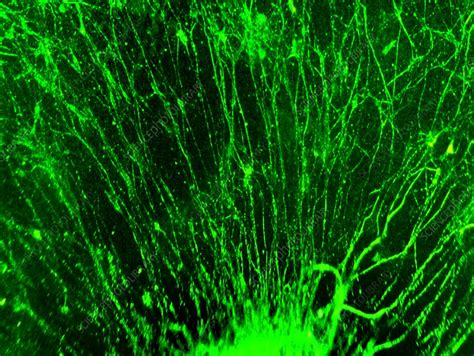 Normal Cerebral Cortex Light Micrograph Stock Image C0480293 Science Photo Library
