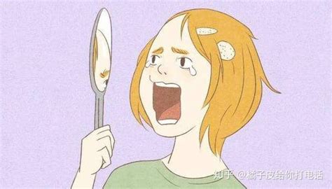 脱发已经不可避免，如何才能让秃顶晚来十年？ 知乎