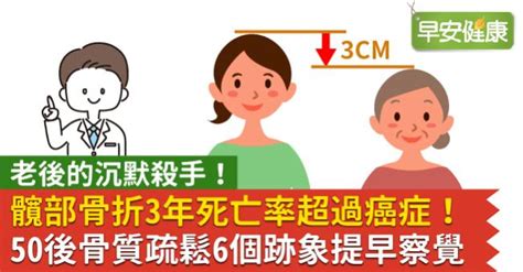 髖部骨折3年死亡率超過癌症！50後骨質疏鬆6個跡象提早察覺