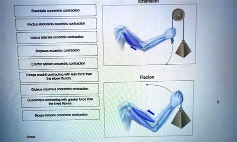 Solved Brachialis Concentric Contraction Rectus Abdominis Eccentric Contraction Vastus