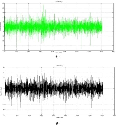 Figure 1 From Chebyshev And Modified Wavelet Algorithm Based Sleep Arousals Detection Using Eeg