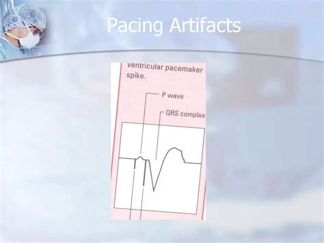 Temporary Pacemaker Pptx