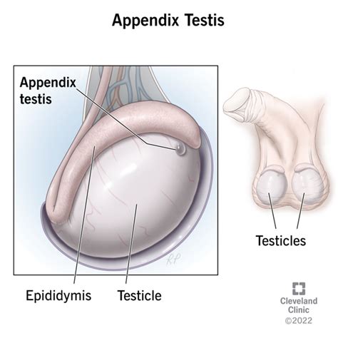 Epididymis Swollen