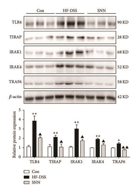 The Effect Of Snn On Tlr4 Mediated Nf κb Activation The Livers Of The Download Scientific