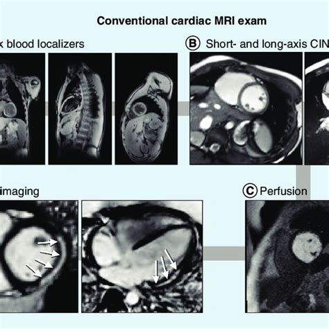 T1 And T2 Mapping Are Quantitative Cardiac Mri Biomarkers That Reflect