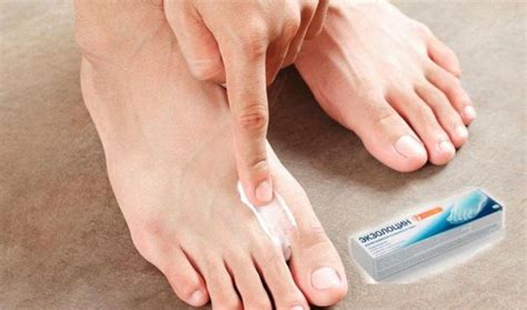 Экзолоцин от грибка ногтей отзывы цена в аптеках аналоги геля