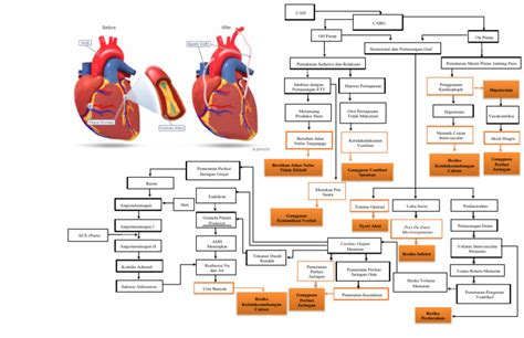 Pathway Cabg Pdf
